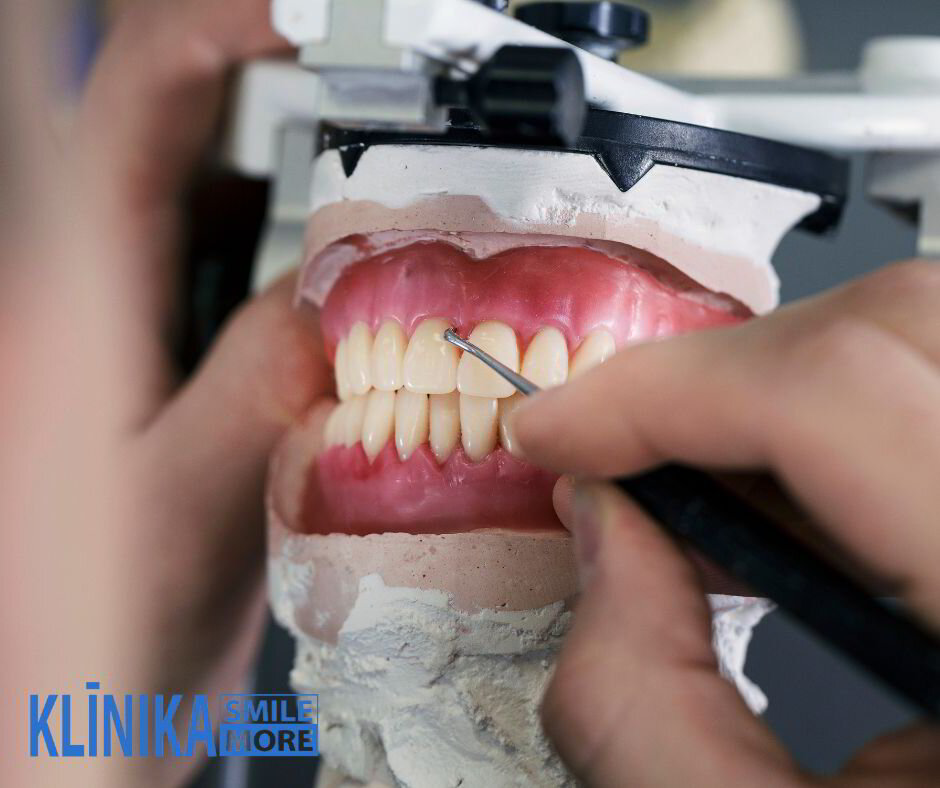 Kādi ir zobu protēžu veidi?